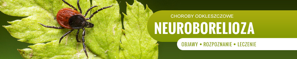 Neuroborelioza